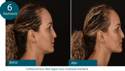CellSound Aesthetics® | Anti-Aging & Contouring