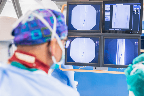 Port Placement: What You Need to Know for Long-Term Treatments I ...