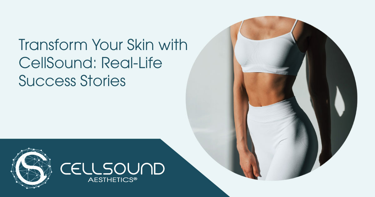 Transform Your Skin with CellSound: Real-Life Success Stories ...