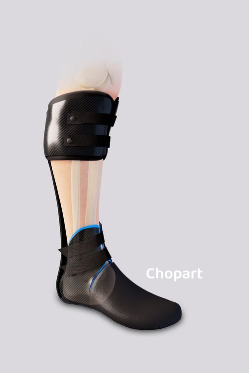 Partial Foot