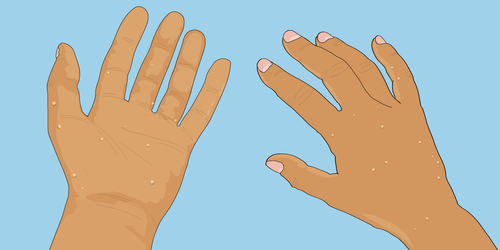 What is BIPOC and why do we use this term? | Violet