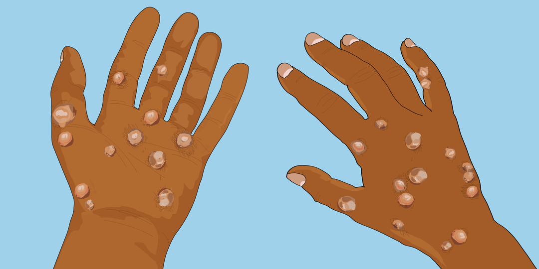 Using gender pronouns in health care.