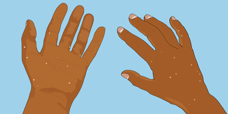 What is BIPOC and why do we use this term? | Violet