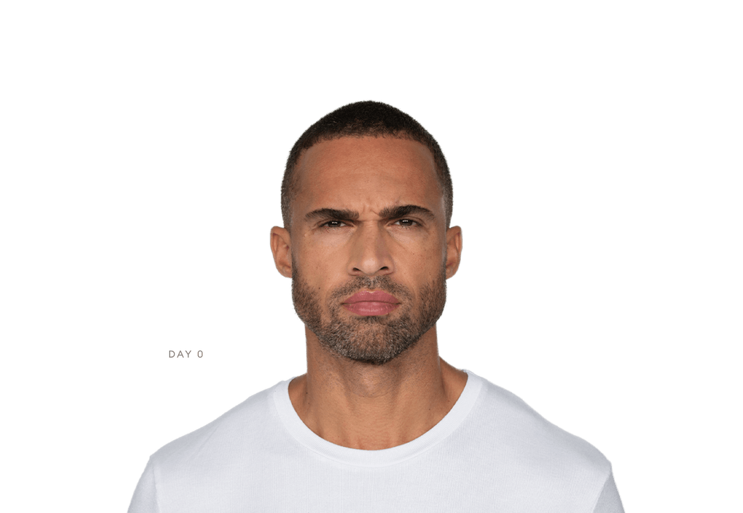 How it works – Jeuveau