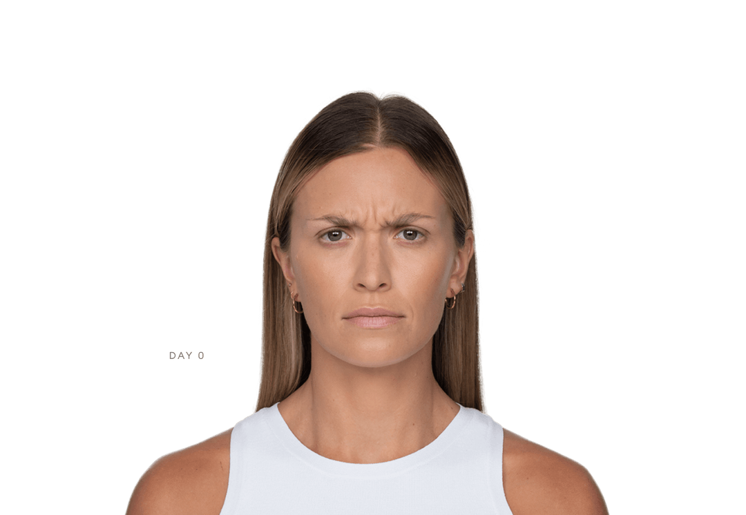 How it works – Jeuveau