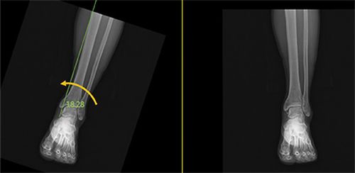 VXvue Acquisition Software