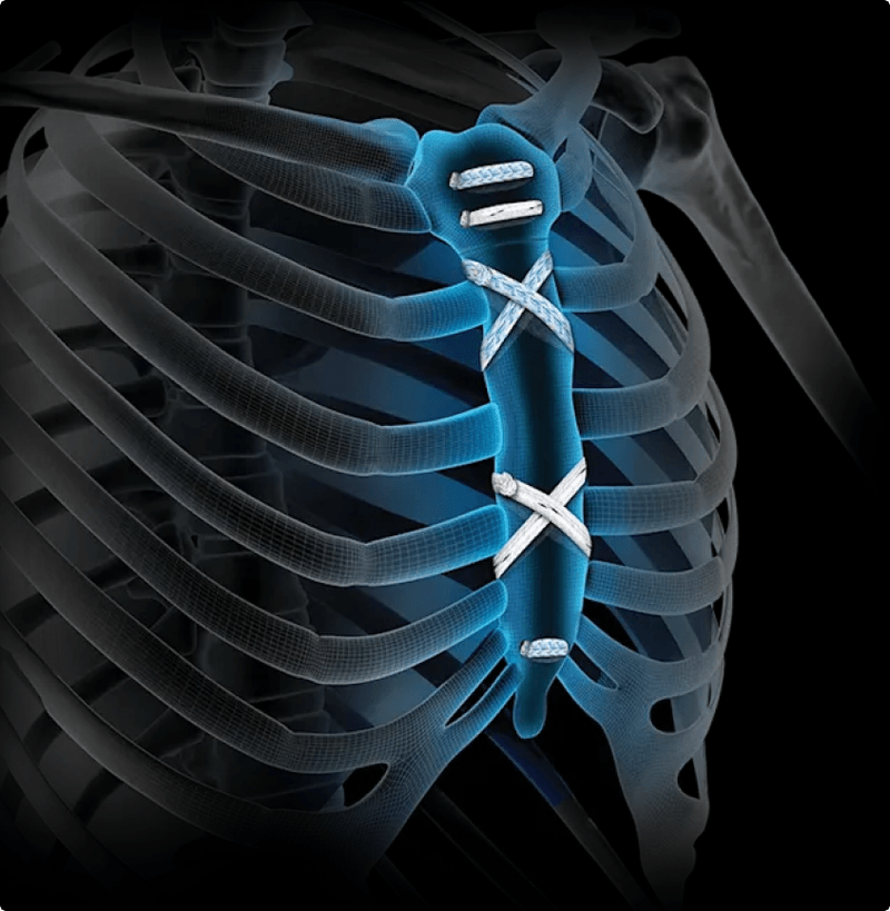 Arthrex Services – Über Arthrex