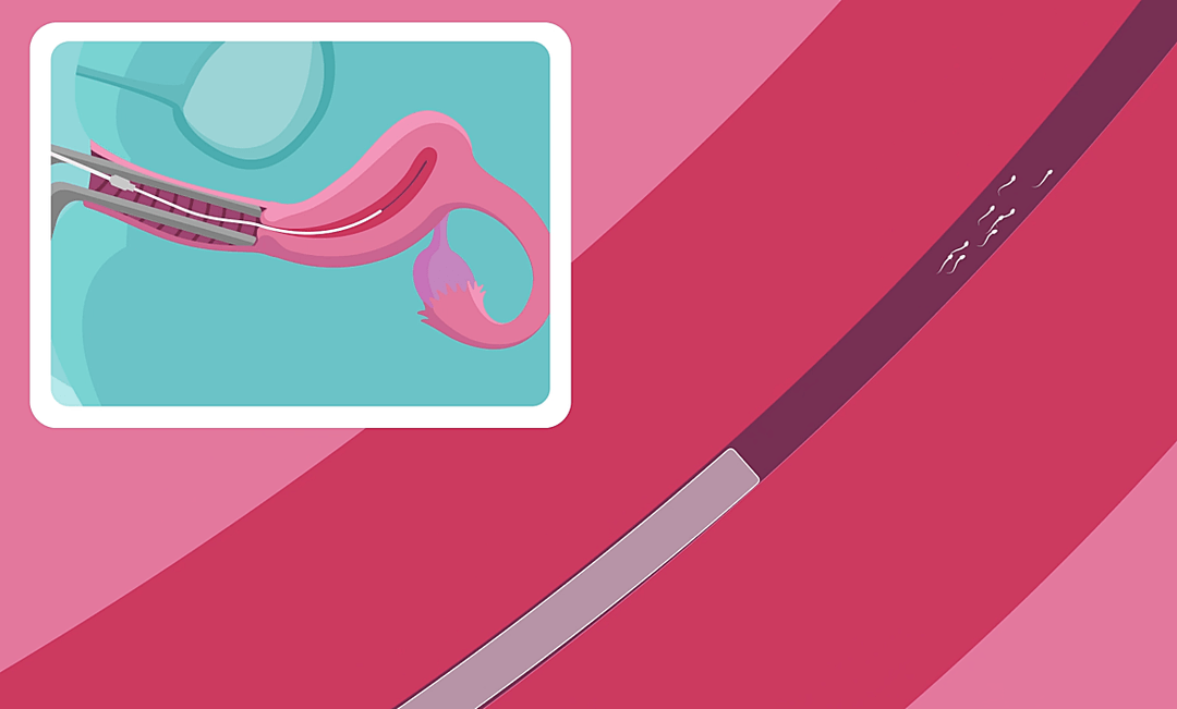 EngagedMD US Fertility eLearning Content
