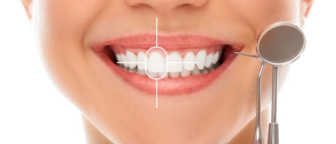Face dos dentes: anatomia, nomes e divisões