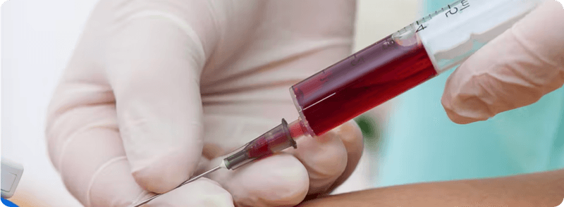 Blood Testing: The Complete Guide