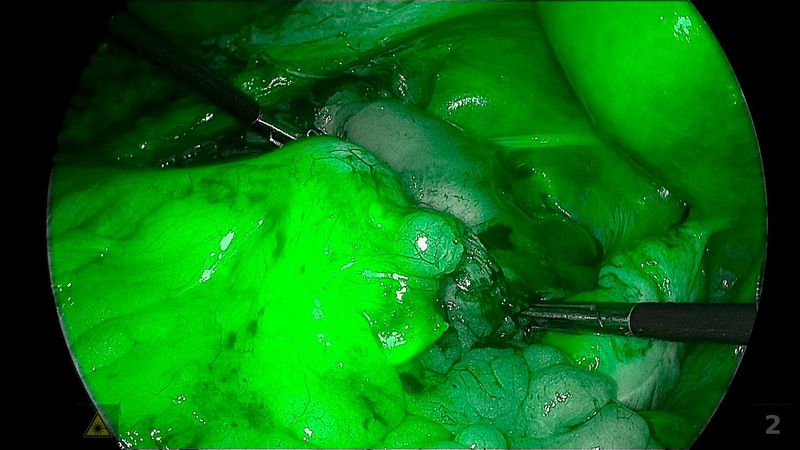 Arthrex Endoskopie und Synergy 4K | Arthrex Endoscopy