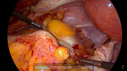 Arthrex Endoscopy and Synergy 4K | Arthrex Endoscopy