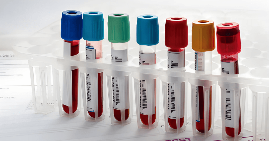 Safety Guidelines for Handling Blood Collection Supplies