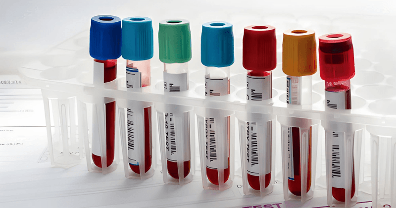 Safety Guidelines for Handling Blood Collection Supplies