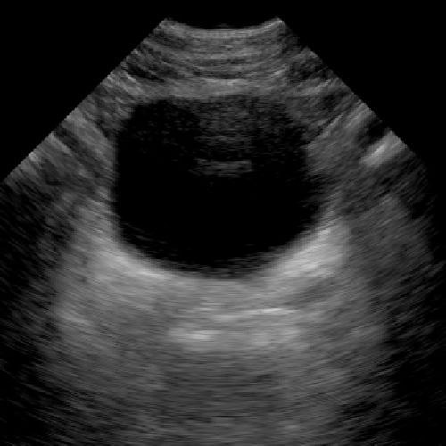 echOpen | simple, accessible clinical ultrasound | Made in France