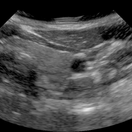 echOpen | simple, accessible clinical ultrasound | Made in France