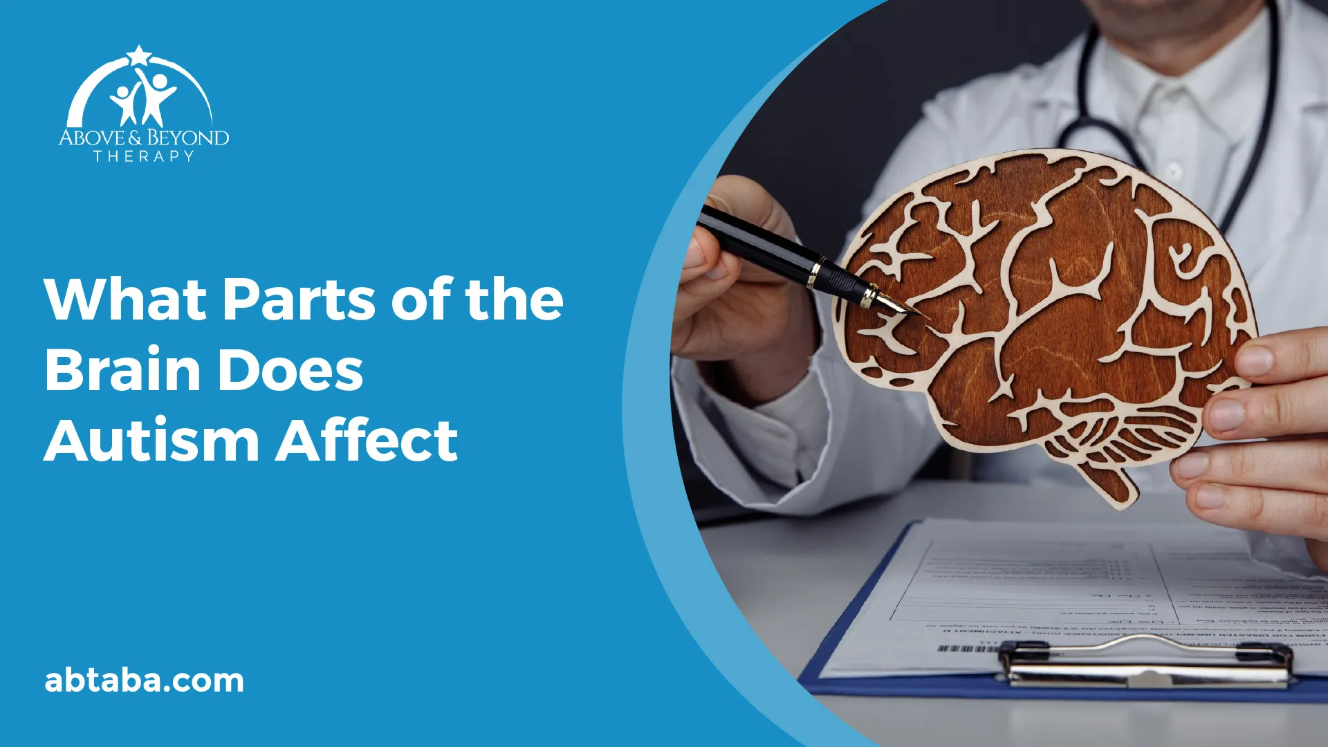 What Parts of the Brain Do Autism Affect