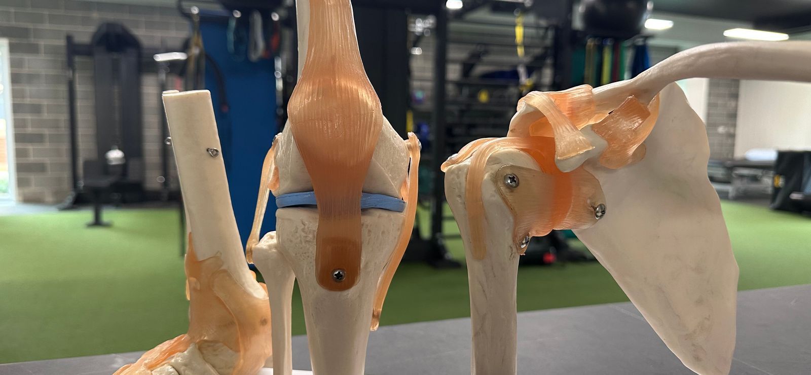 Debunking the Misconception: "Bone on Bone" and Osteoarthritis ...