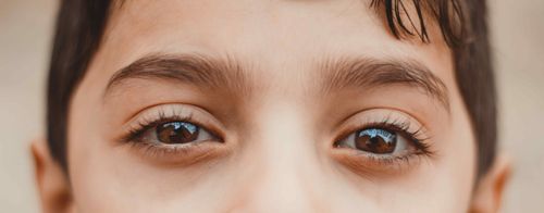 Excessive Blinking in Children with Autism: Causes and Treatments ...