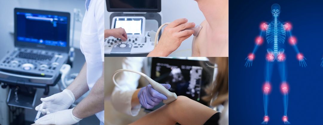 Ultrasound Guided Barbotage