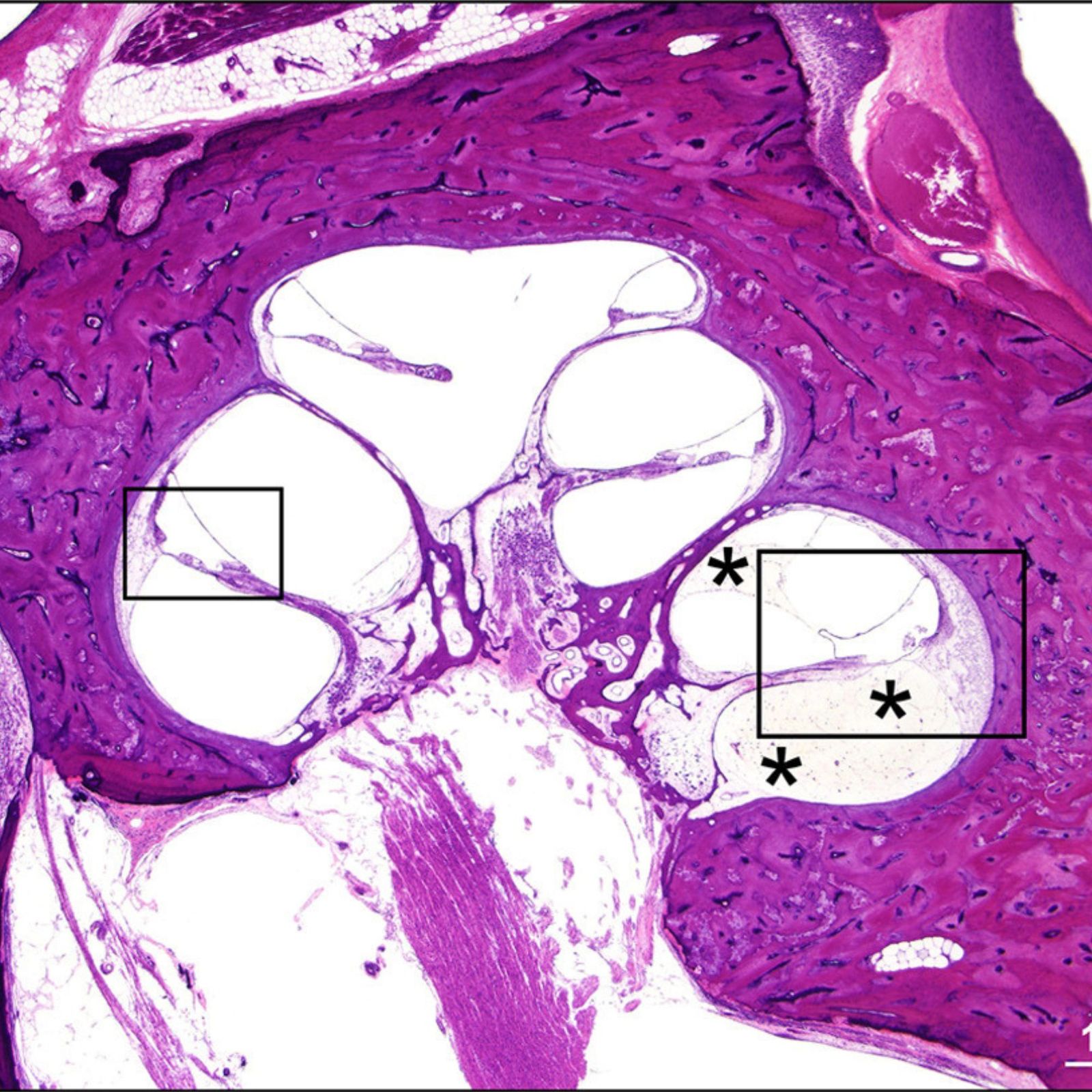 MSTB-3 | Institute for Cochlear Implant Training