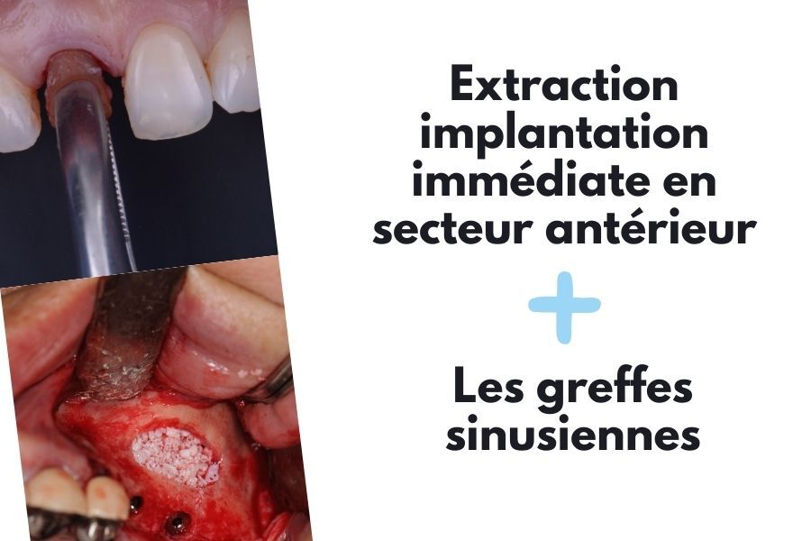 Formations chirurgie-dentaire : optimisez votre pratique