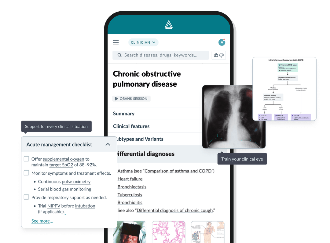 USMLE® Step 2 CK preparation: Study with AMBOSS