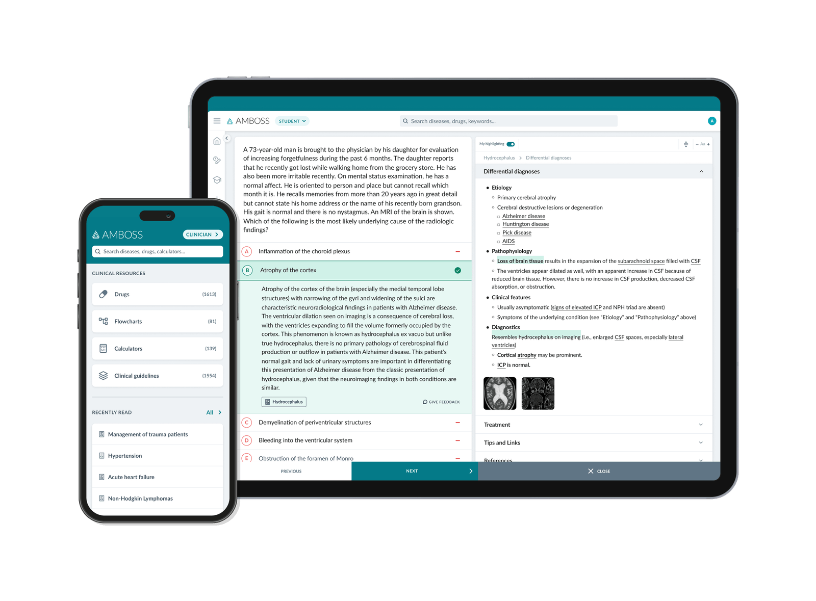 Best resources in medical school: AMBOSS library, Anki add-on