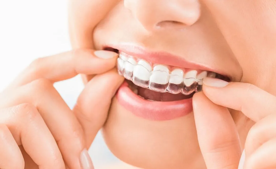 Reliable Dentist In Bedford, Colleyville and Euless TX | Nirvana Dental