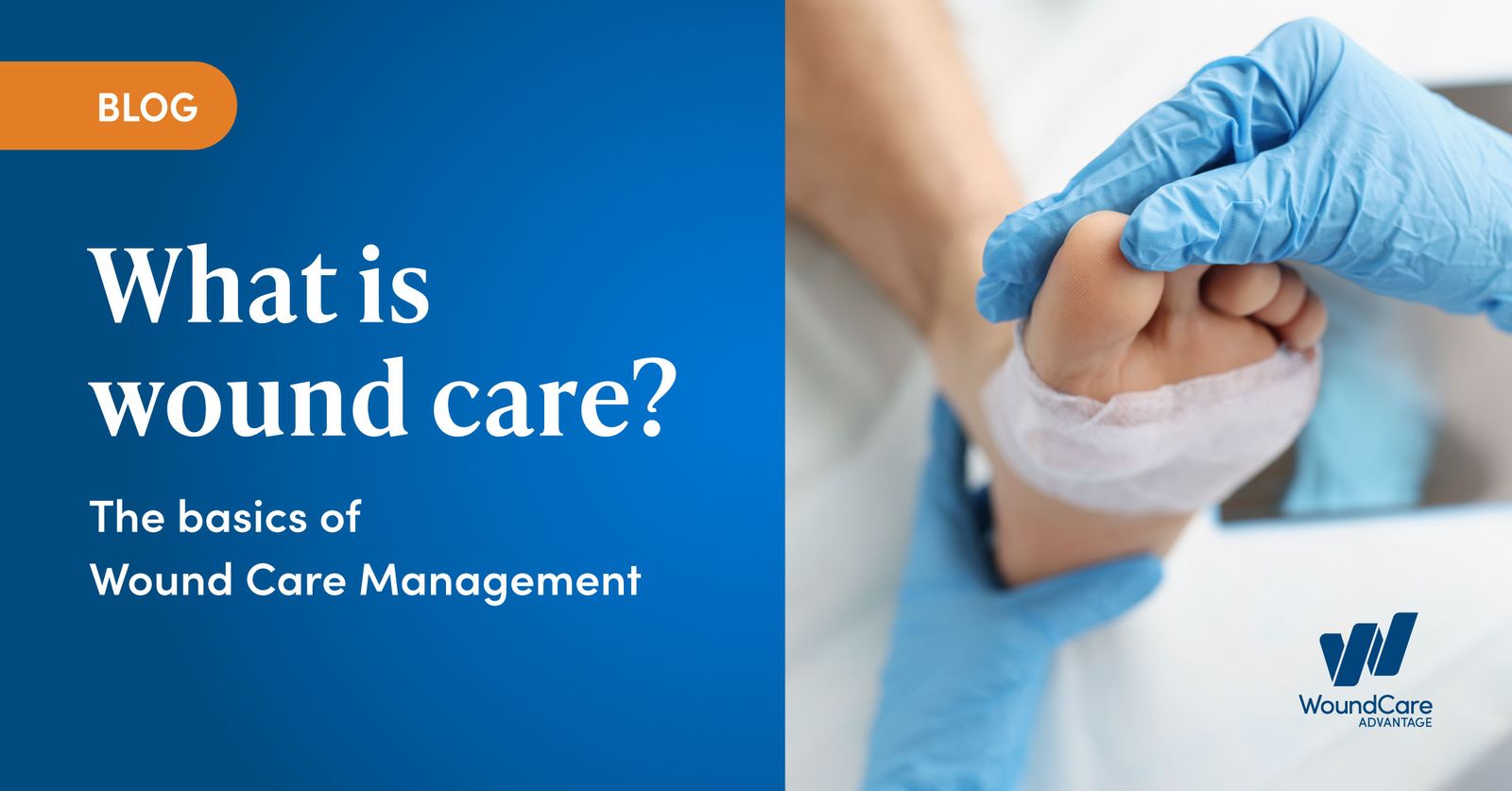 What is wound care? The basics of Wound Care Management
