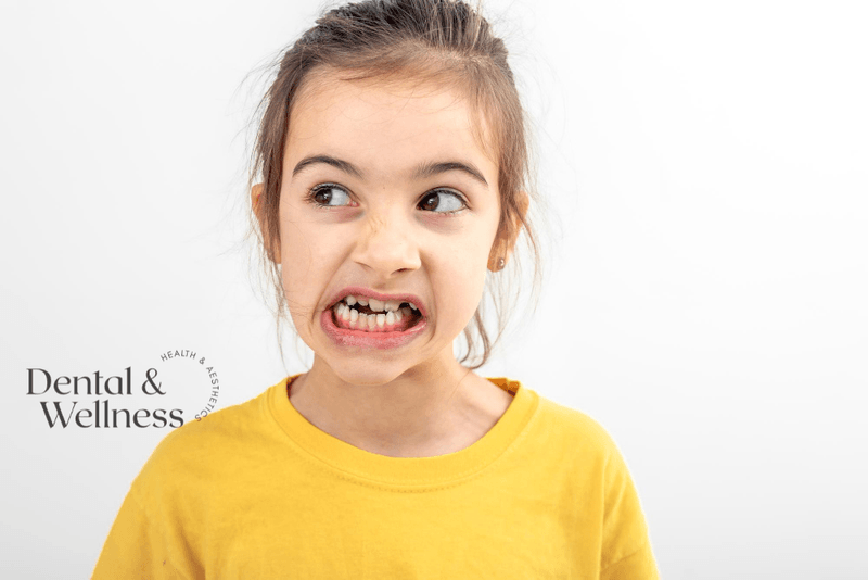 Chipped Tooth: Causes, Treatment, and How to Prevent It