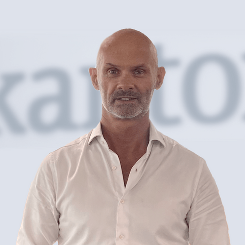 Exploring FX Derivatives: Forwards vs. Options - Kantox