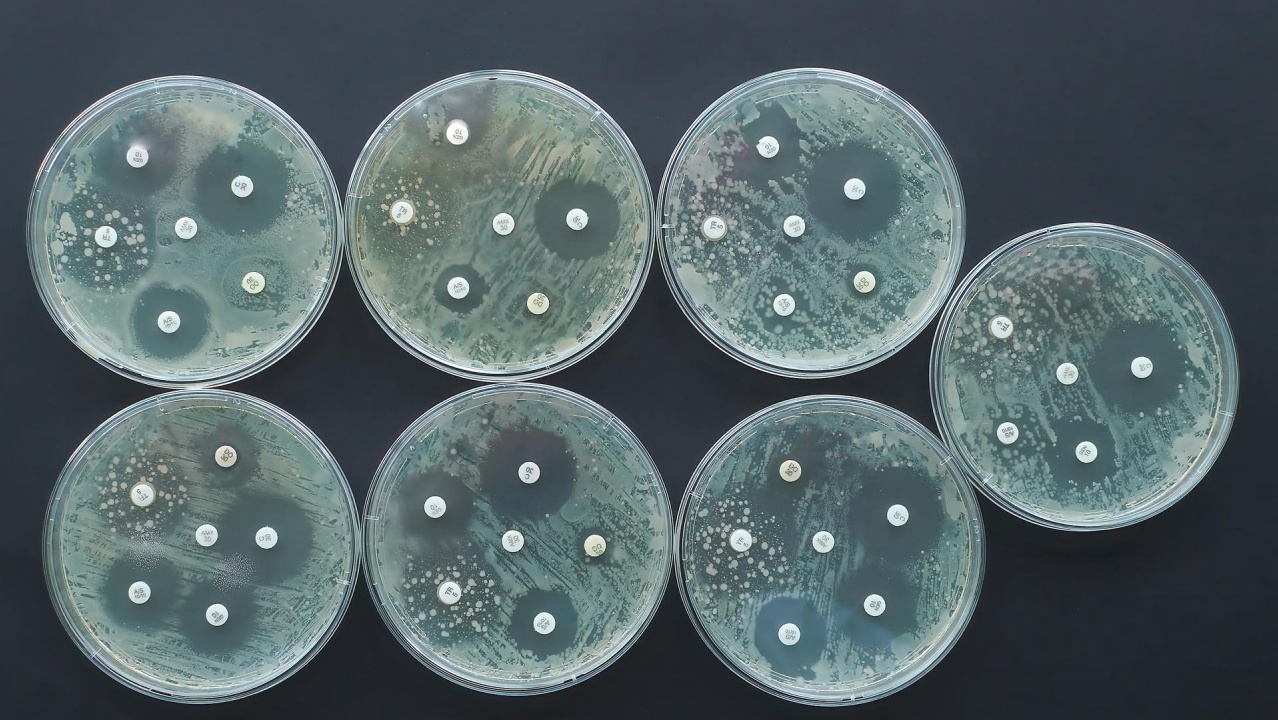Bacteria vs. science: A race against the resistance | CAS