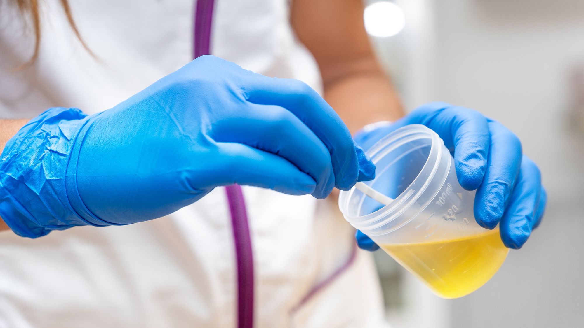 How to Detox for a Drug Test: Effective Methods and Tips - Elev8 centers