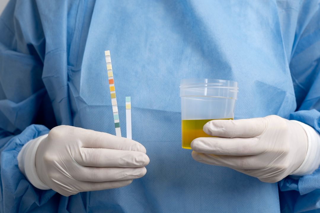 How Long Does Alcohol Stay in Urine: Facts and Myths Explained - Elev8 ...