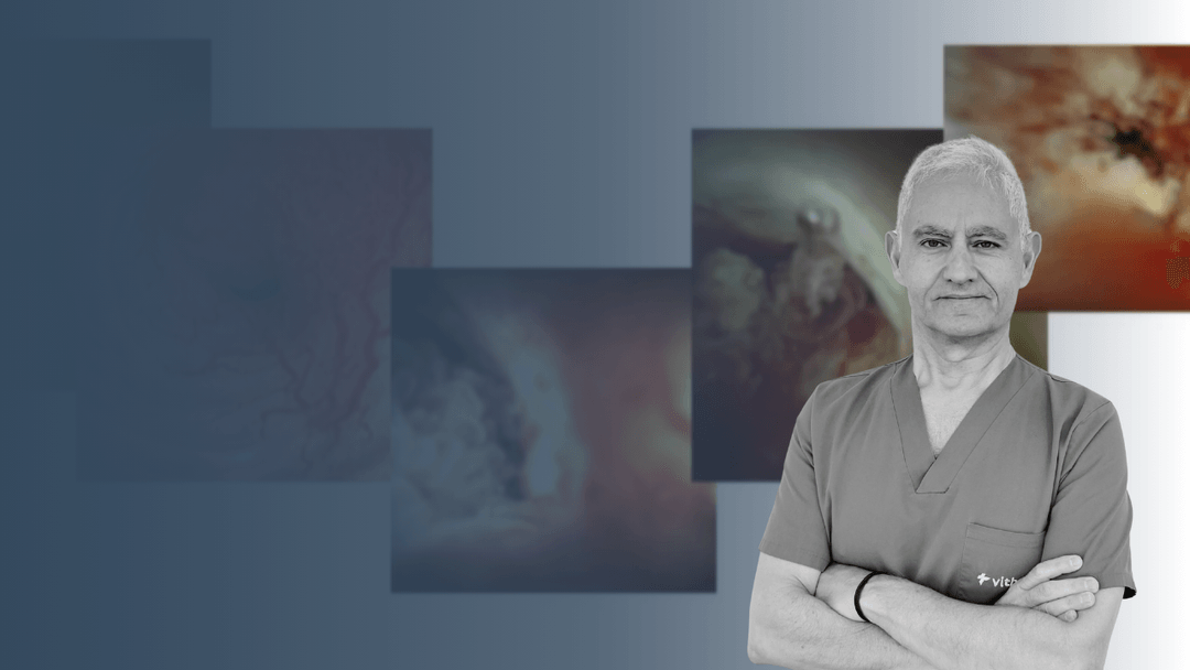 El Arte de la Biopsia en Endoscopia: ¿Cuándo y cómo hacerlo bien? Parte ...