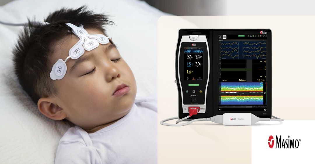Masimo - New Study Finds Masimo SedLine® Brain Function Monitoring ...