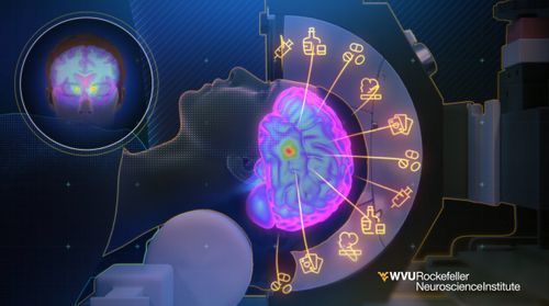 Top 10 Examples of Medical Animations That Inspire Healthcare Education ...