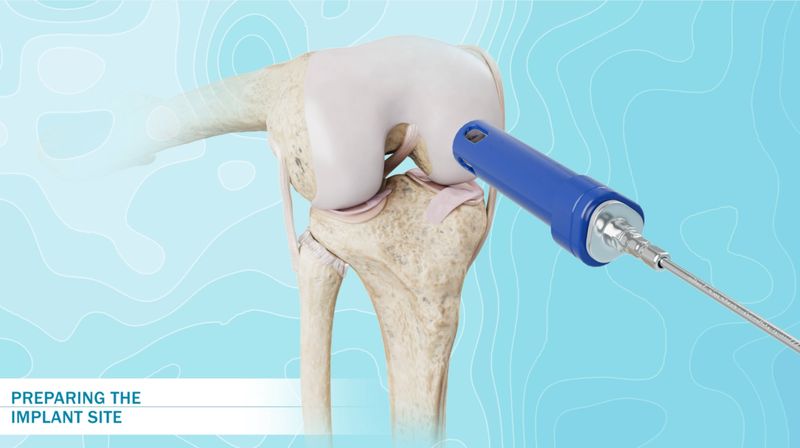 Top 10 Examples of Medical Animations That Inspire Healthcare Education ...