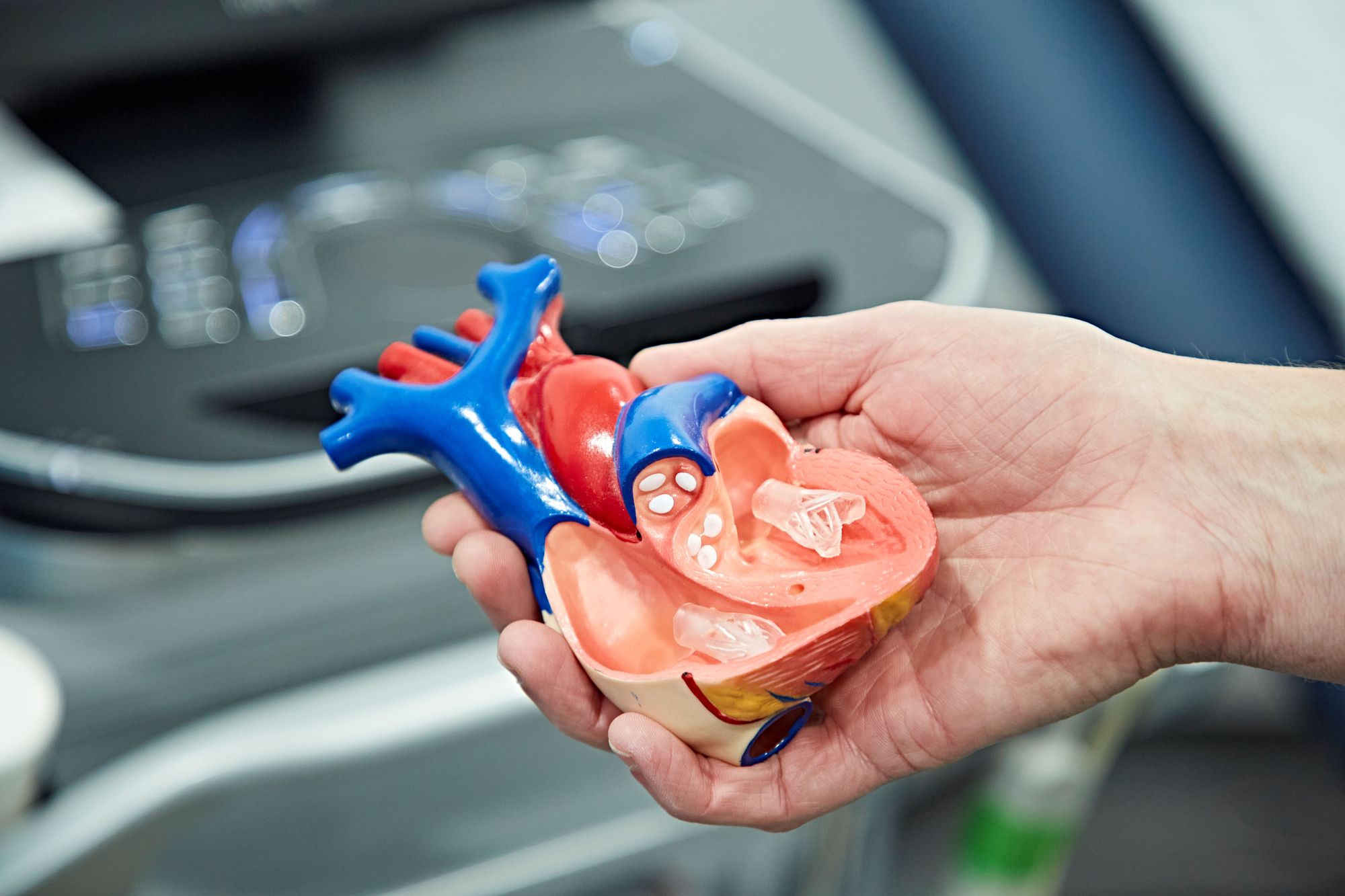 Ultracardiac | Echocardiography | Heart Ultrasound Scans