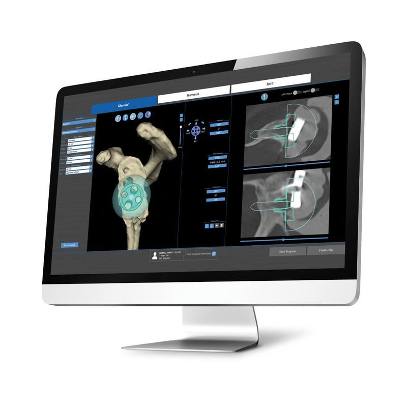 Planning with Blueprint® | Stryker