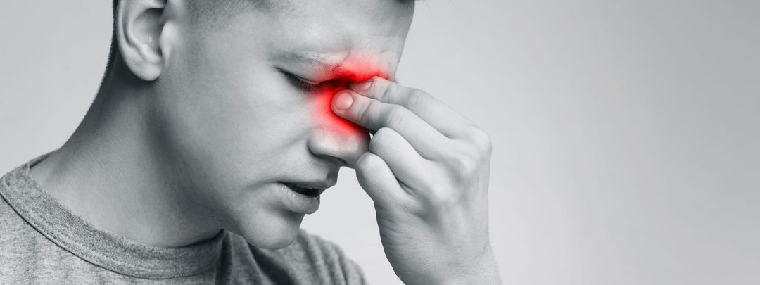 Sinusitis Headaches: Causes, Symptoms, and Treatment