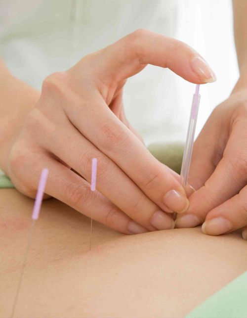 Free Acupuncture Software | Carepatron