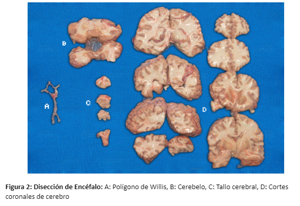 Apuntes sobre la autopsia forense | Physios