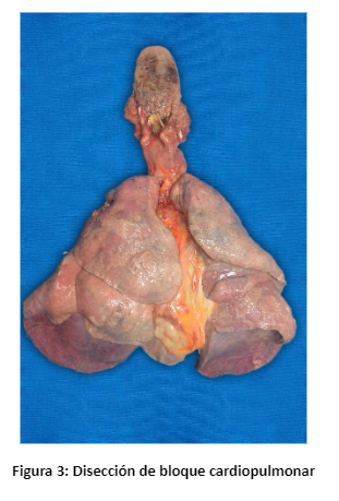 Apuntes sobre la autopsia forense | Physios