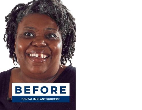 24 Hour Dental Implants in Chicago - Nuvia Dental Implant Center