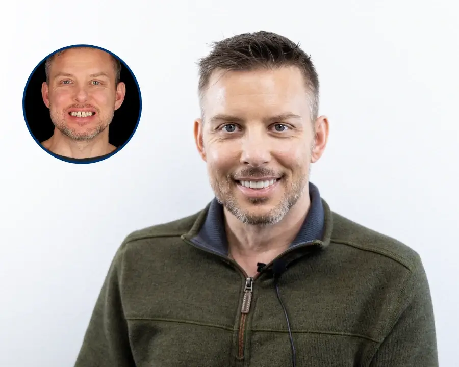 5 Things You Need to Know About Dental Implants - Nuvia