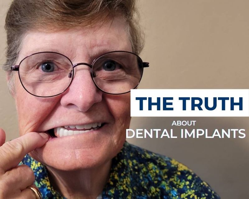 Botched Dental Implants: What Can Go Wrong