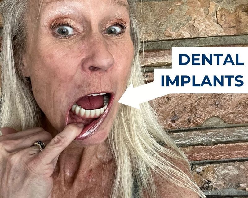 Are Dentures for Elderly People the Best Option? Pros and Cons