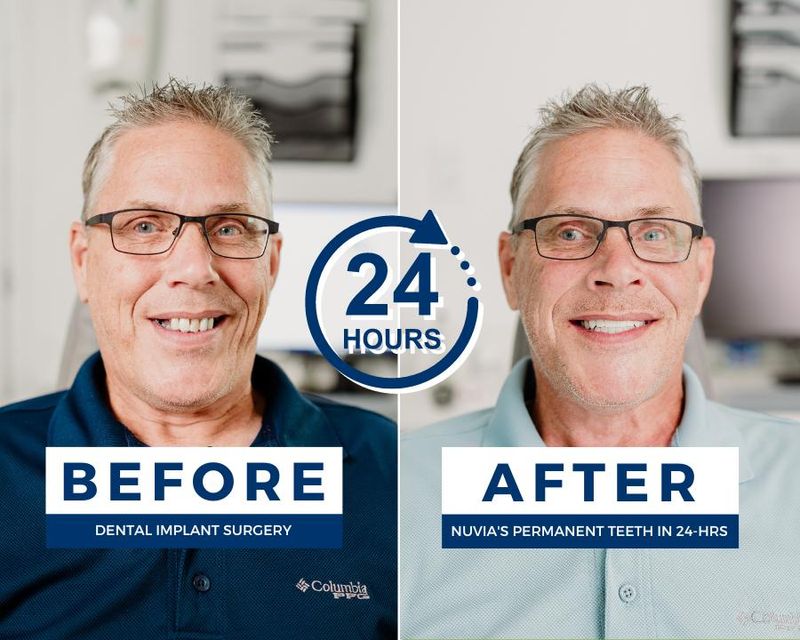 3 Years Later - Best Part and the Worst Part of Dental Implants